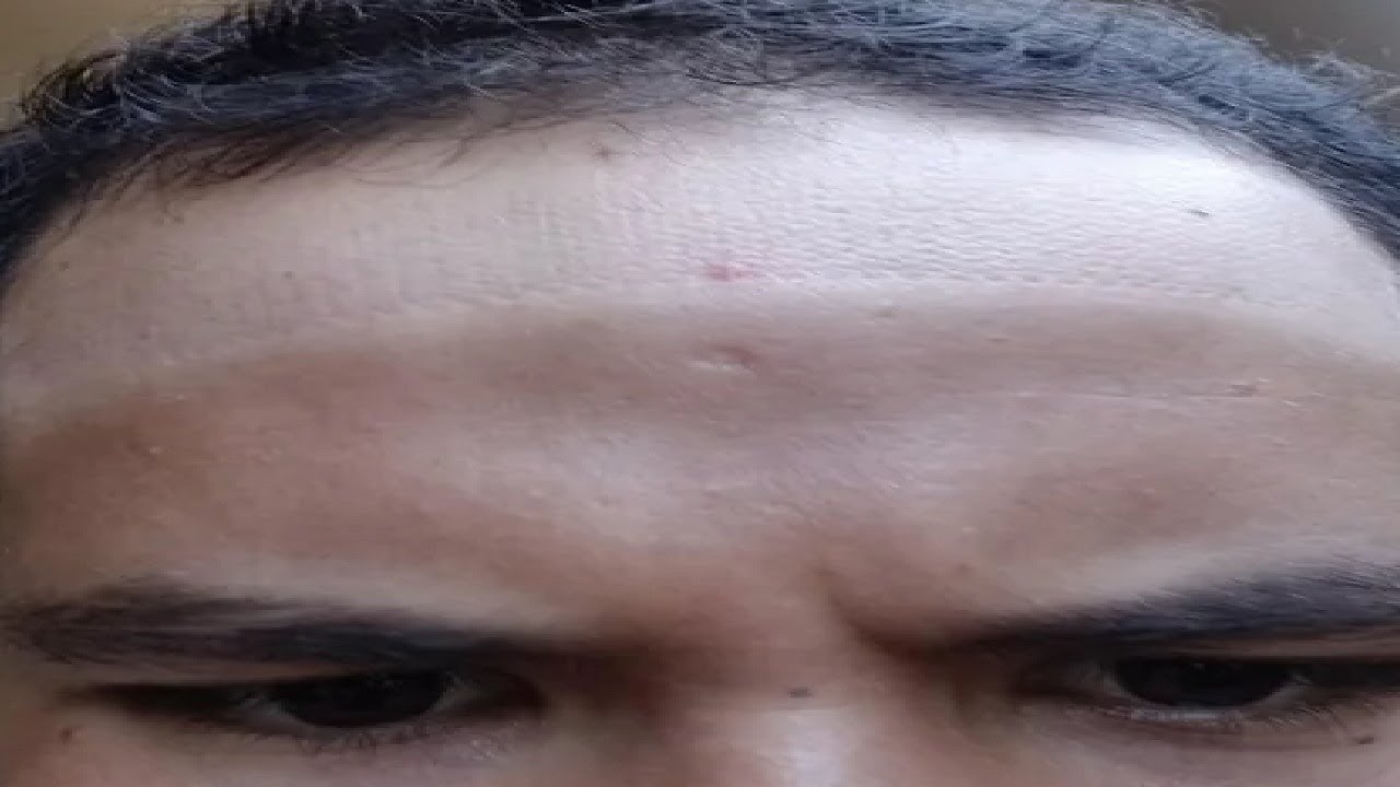 how to get rid of a tan line on your face fast - YouTube