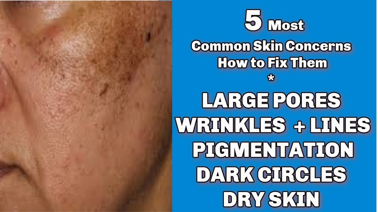 5 Most Common Skin Concerns and How to Fix Them - YouTube