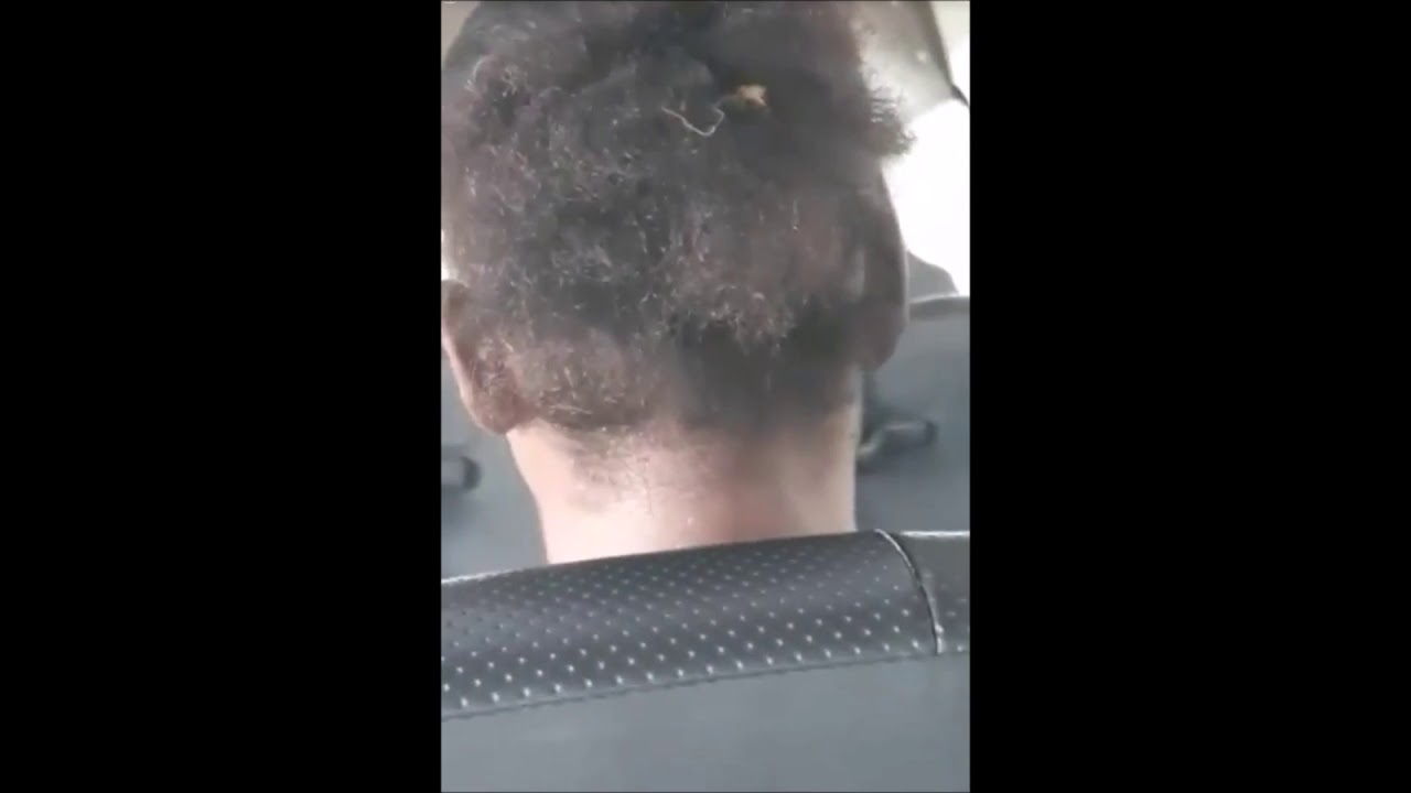 Roach Crawling In A Womans Hair While On A Bus - YouTube