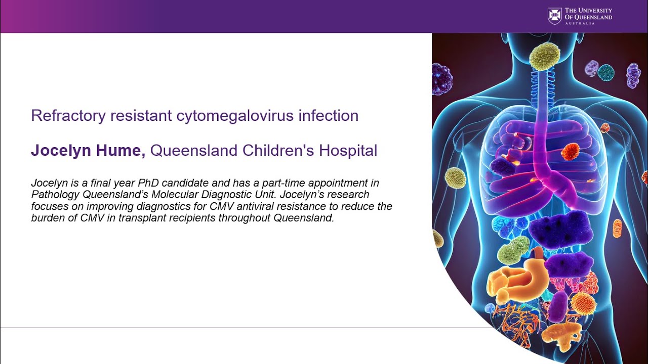 Session 4: Jocelyn Hume Refractory resistant cytomegalovirus infection ...