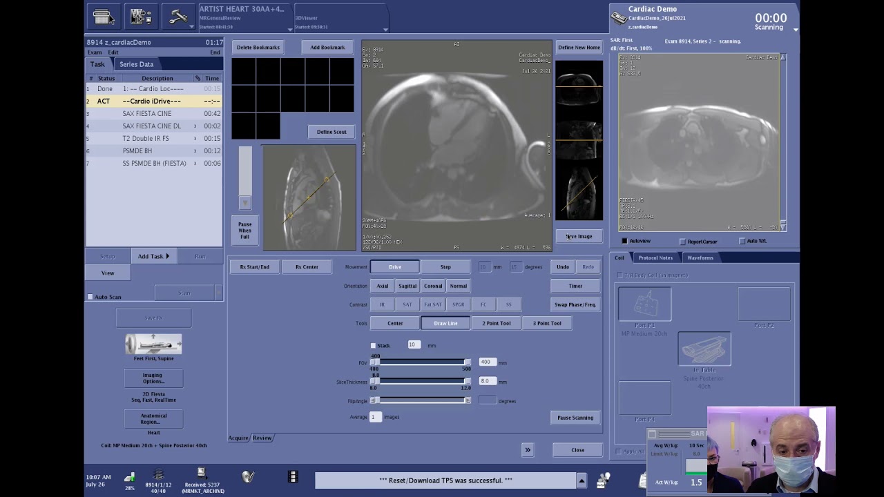 Cardiac Imaging SIGNA™Works AIR™ IQ Edition - YouTube