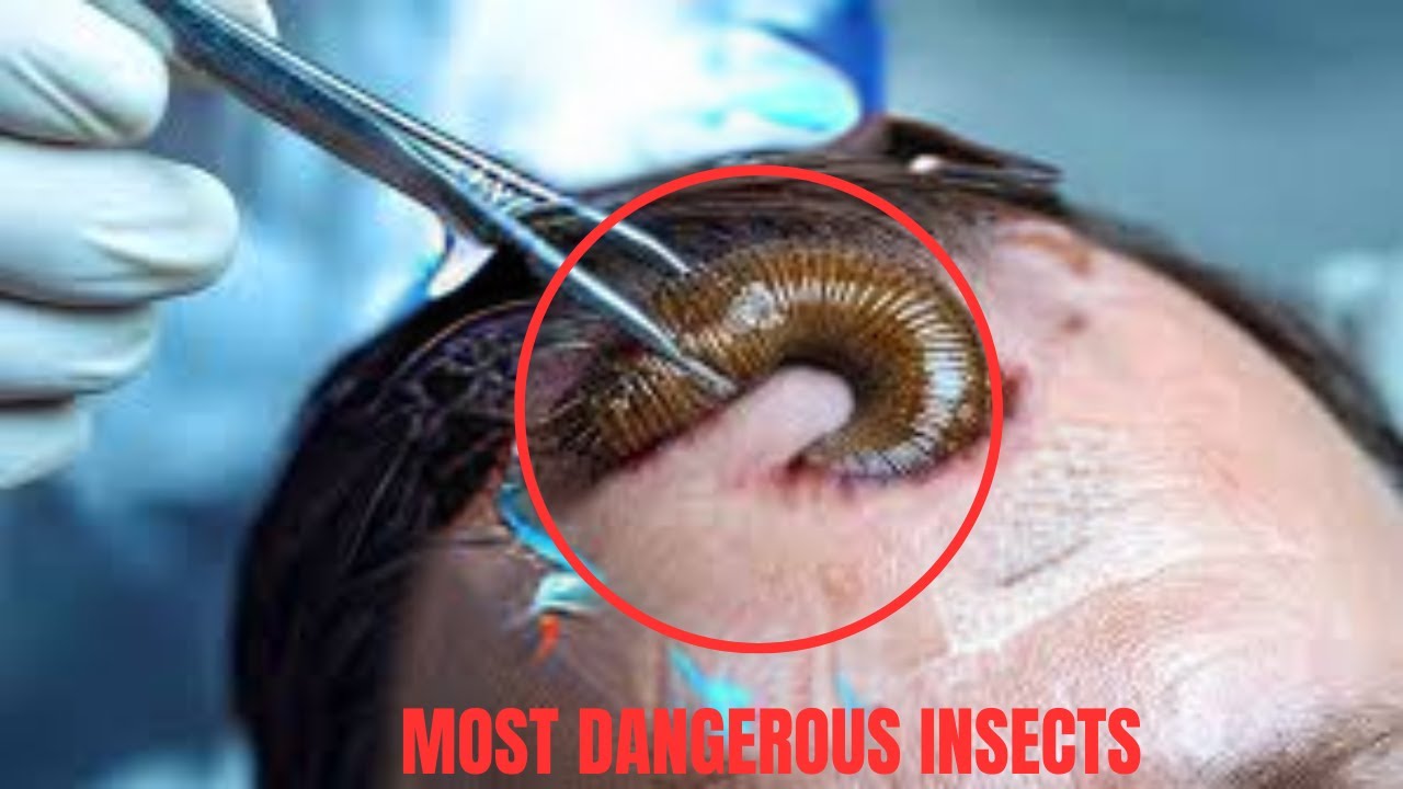 Most Dangerous Insects In The World Lurking Around YOU.. - YouTube
