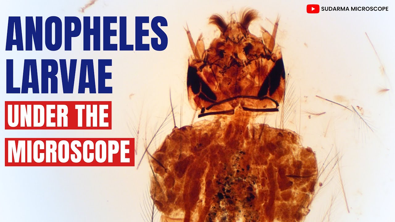 Anopheles larvae under the microscope - YouTube
