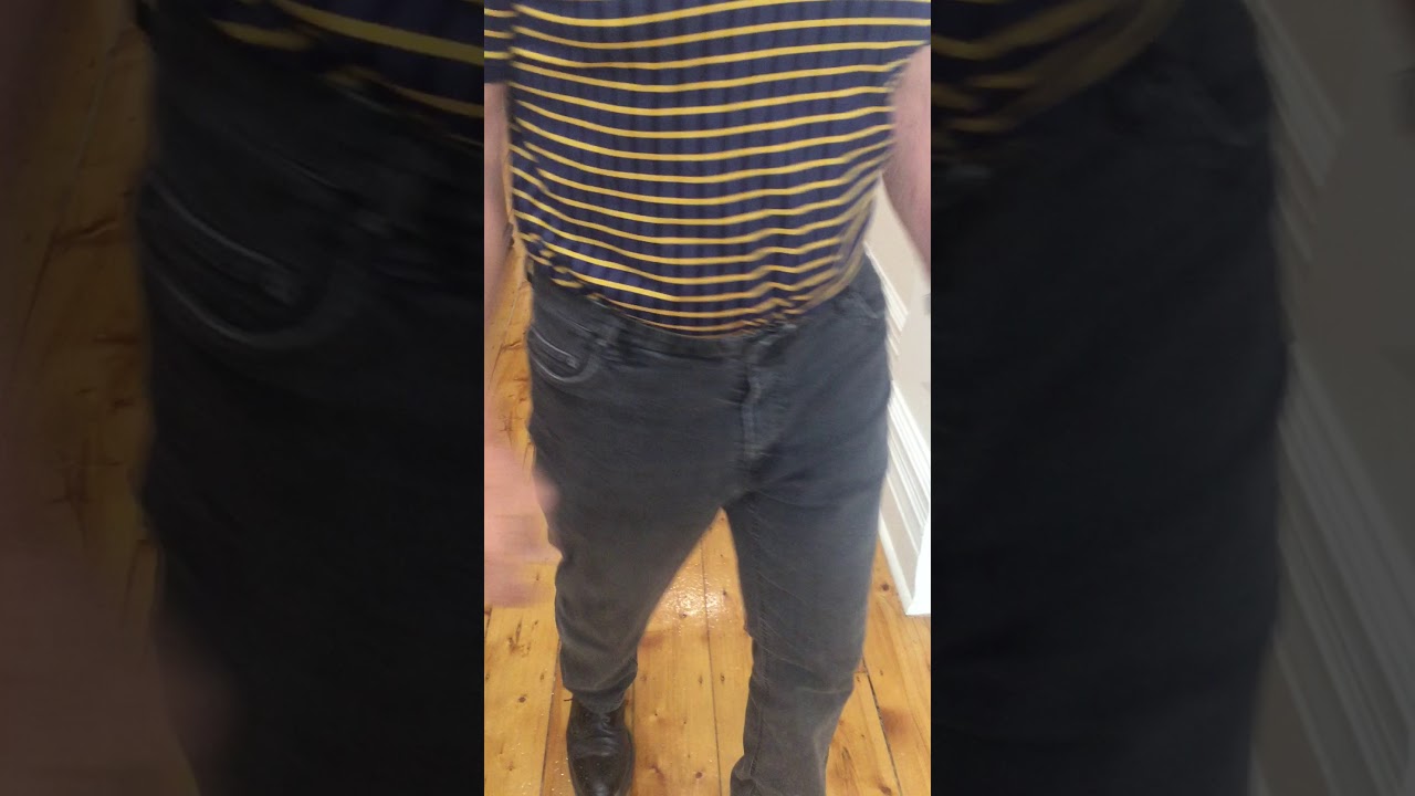 Bikini Hip Replacement: Patient Walking with No Limp 2 Weeks after ...