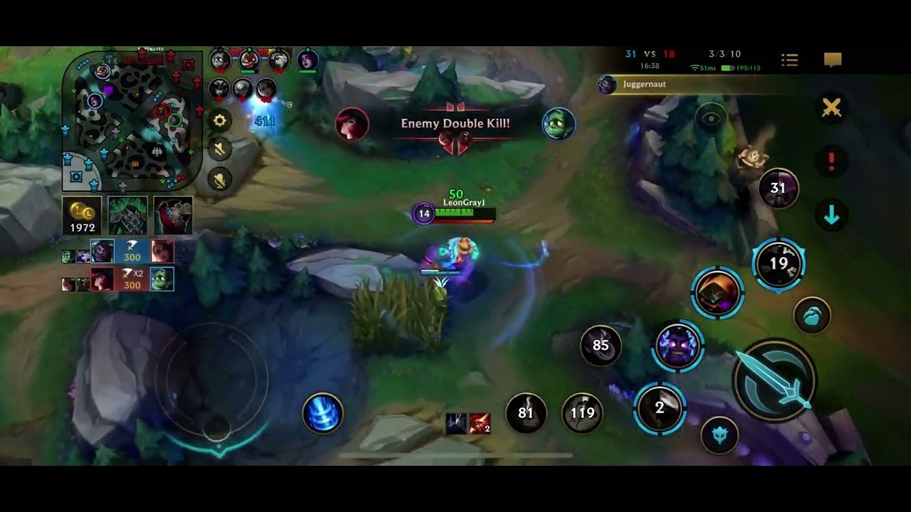 This Dr. Mundo Build is so Fun and Annoying to the Enemy 🟡League of ...