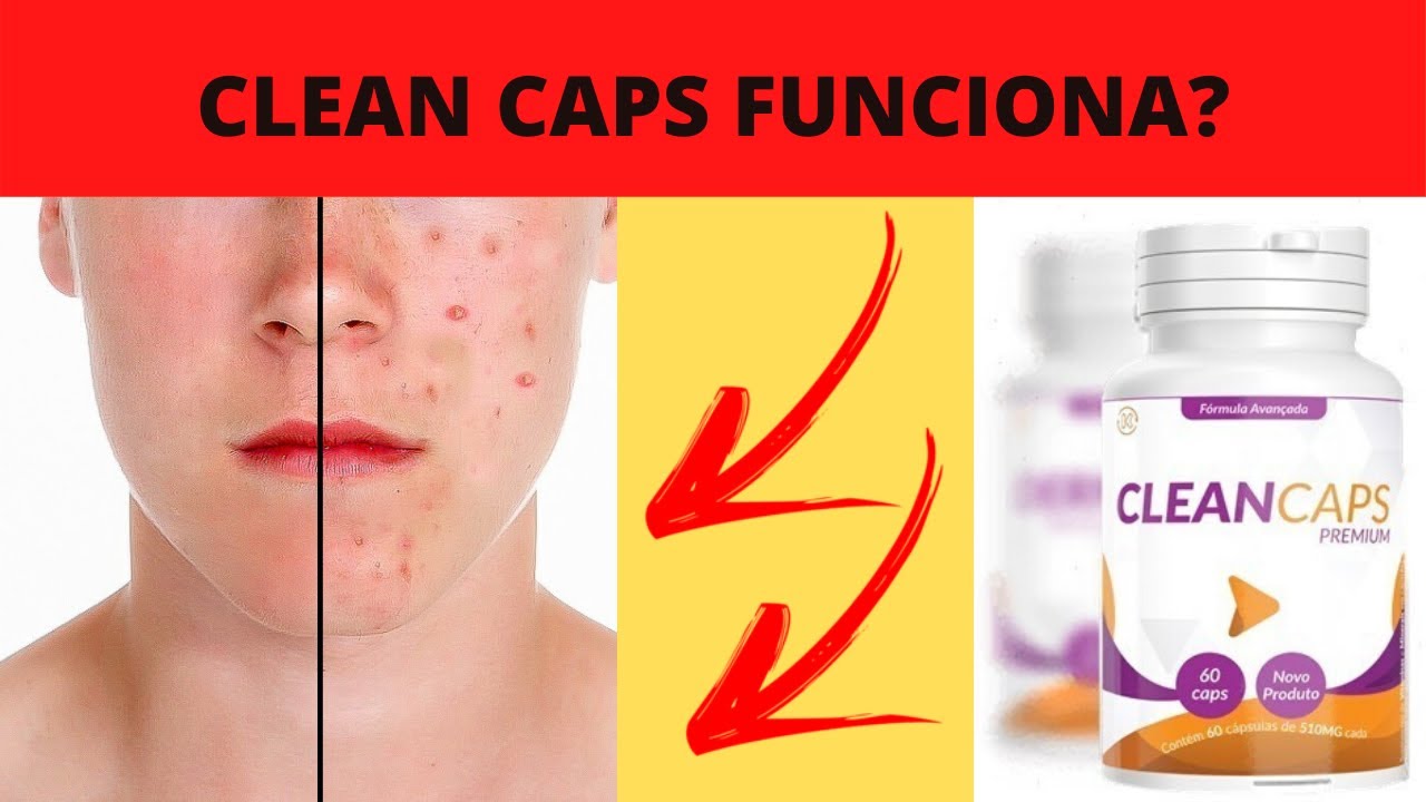 Clean caps | clean caps funciona?clean caps funciona mesmo?clean caps é ...
