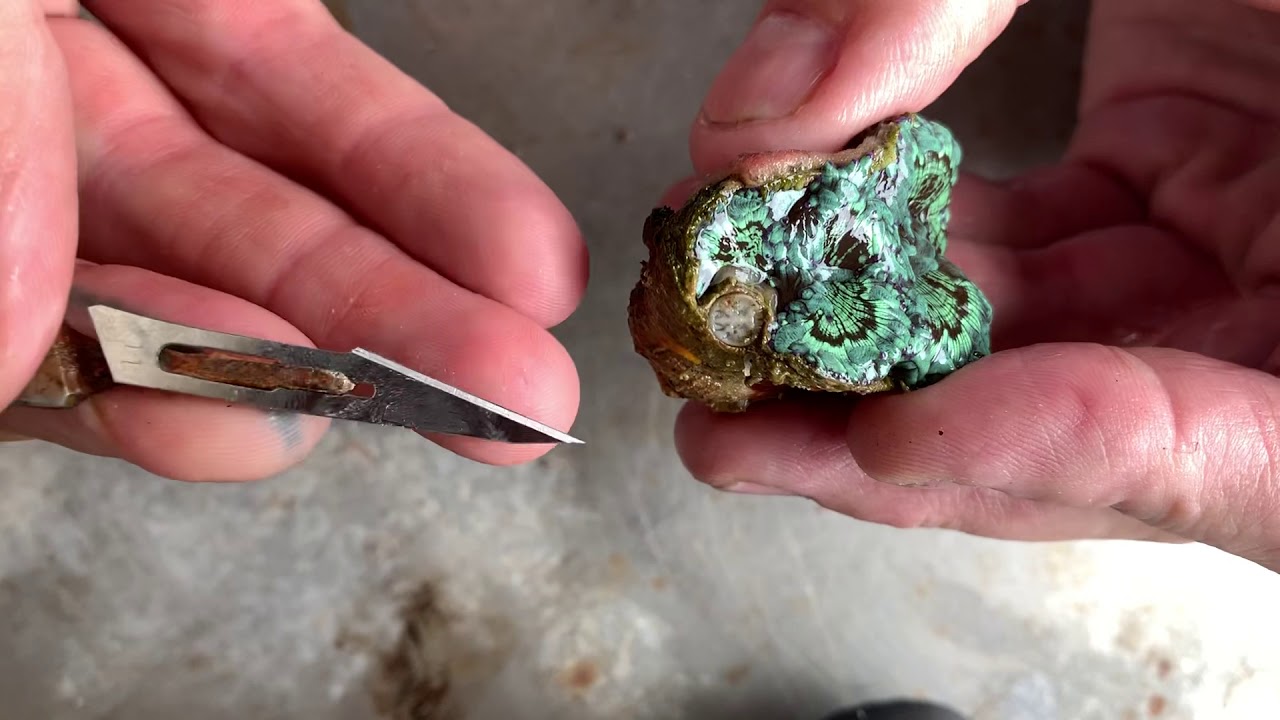 Gall Crab Removal - YouTube