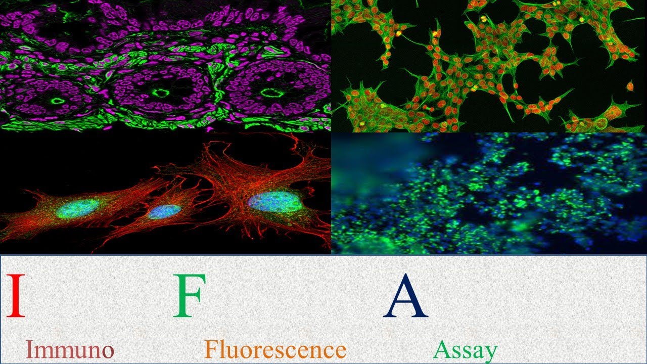 Immunofluorescence Assay (IFA) - YouTube