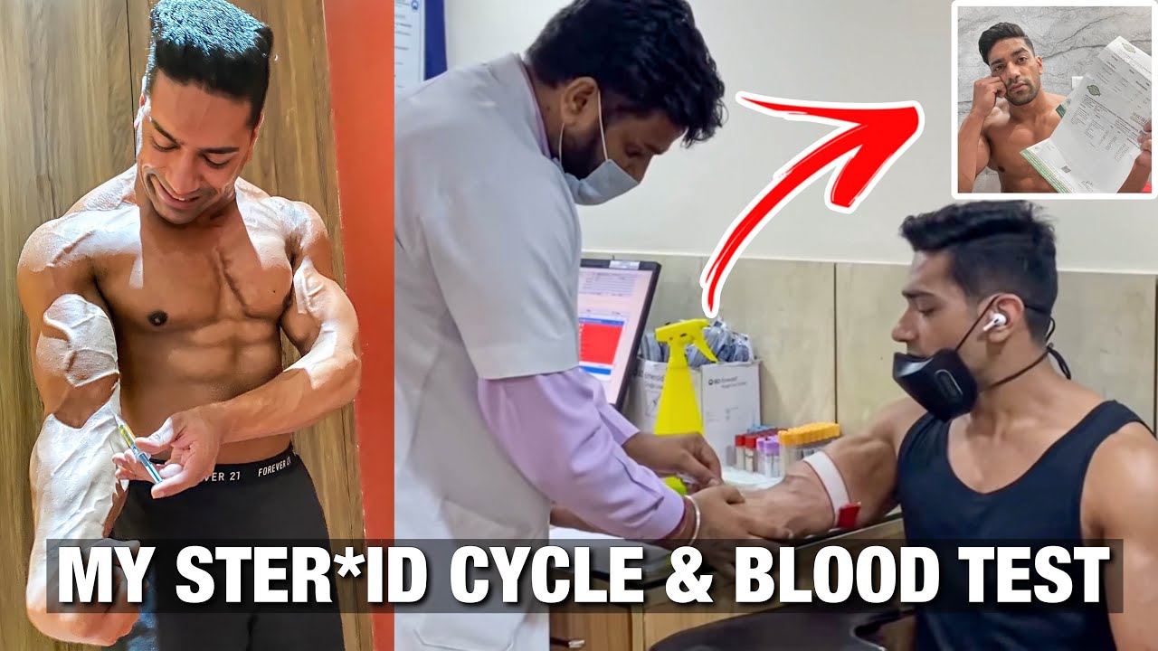 My Ster*id Cycle & Test Report - YouTube
