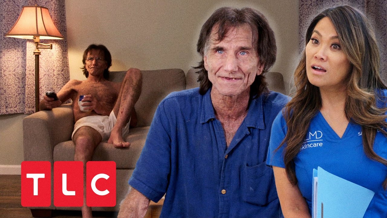Morbus Darier: Seit 60 Jahren juckt Jimmy's ganzer Körper | Dr. Pimple ...