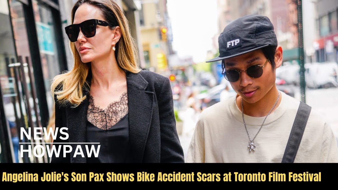 Angelina Jolie's Son Pax Shows Bike Accident Scars at Toronto Film ...