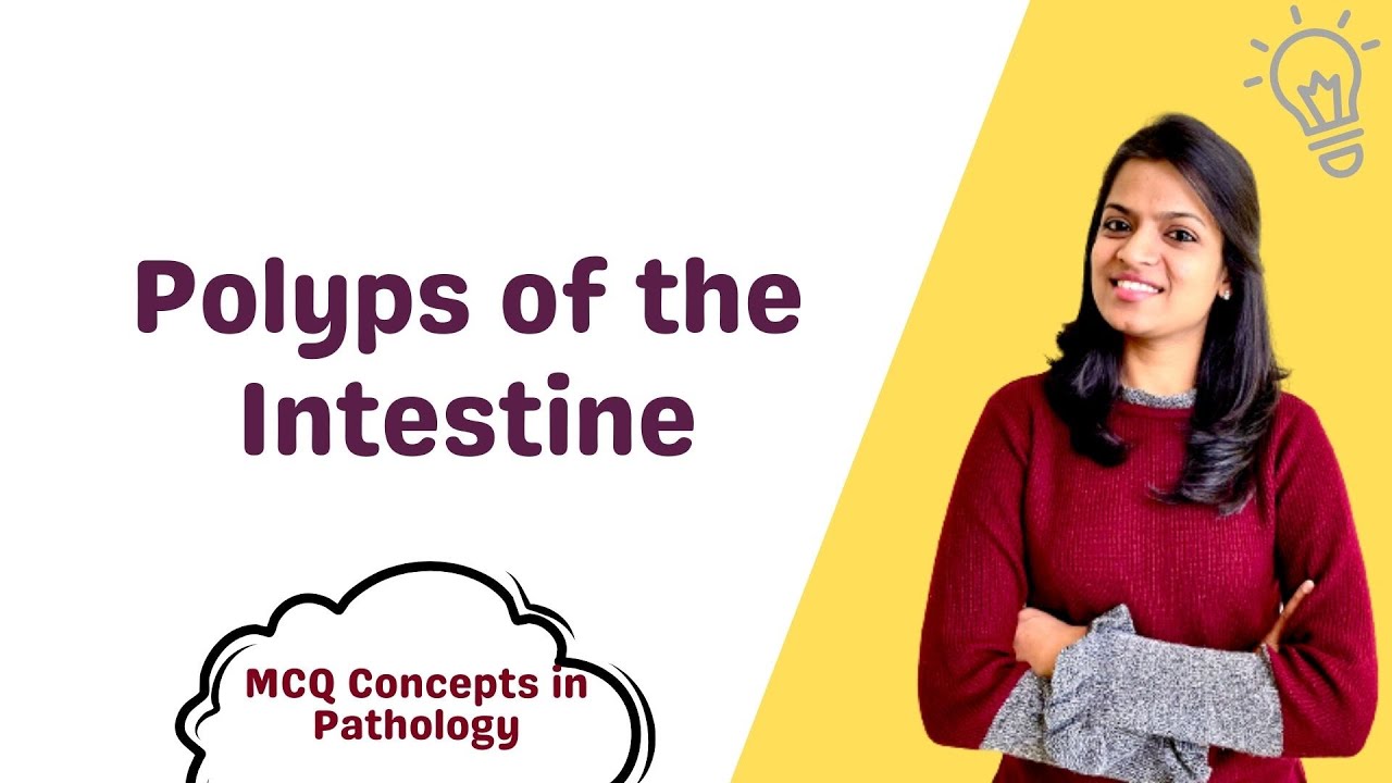 Non neoplastic & Neoplastic polyps of the intestine - MCQ concepts ...