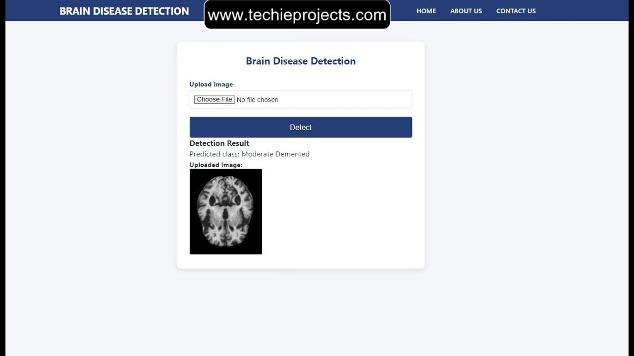 Brain Stroke Detection using Machine Learning | Brain Disease Detection using Deep Learning ...