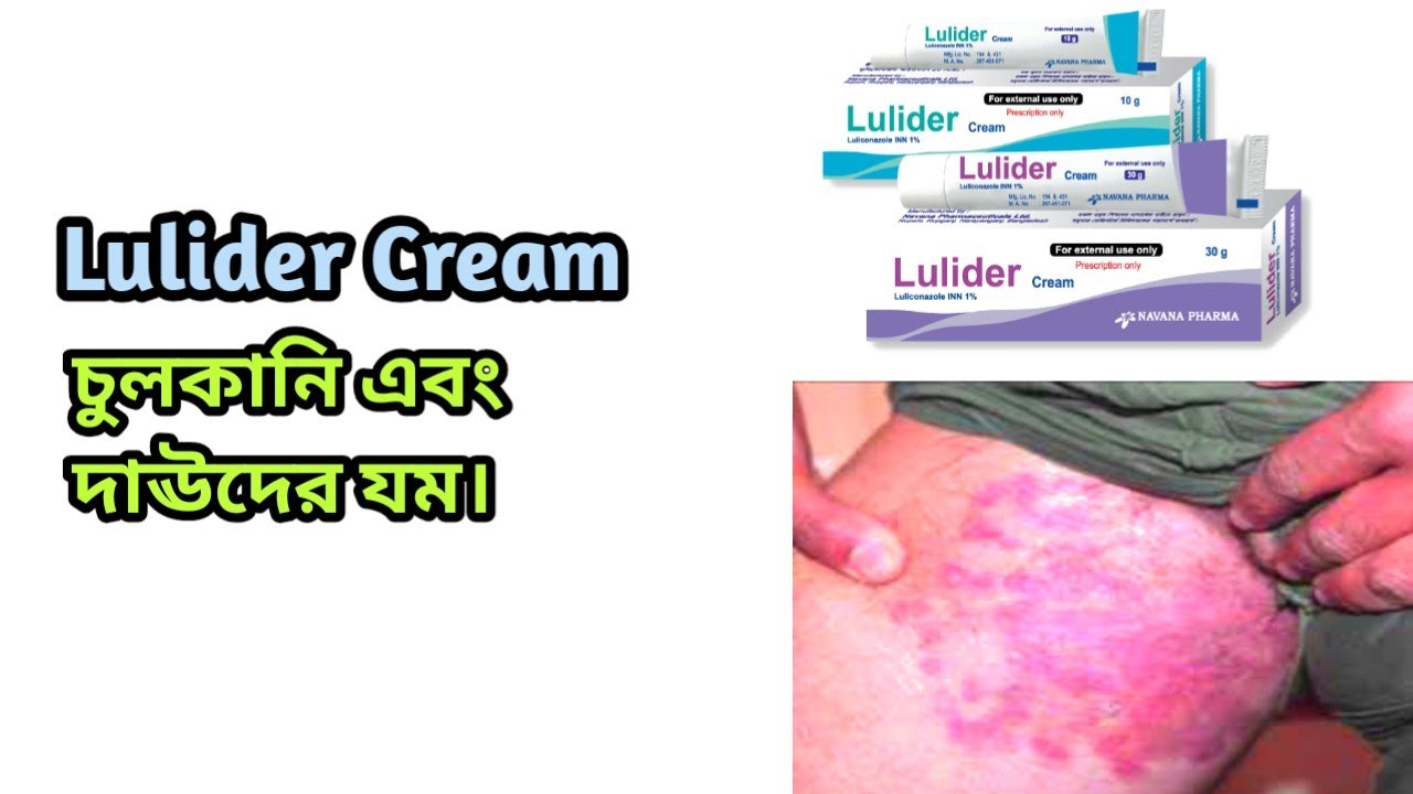 লুলিডার ক্রীমের রিভিউ | Lulider cream uses - YouTube