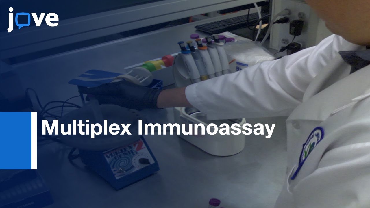 Multiplex Immunoassay to Measure Human exposure to Pathogens | Protocol ...