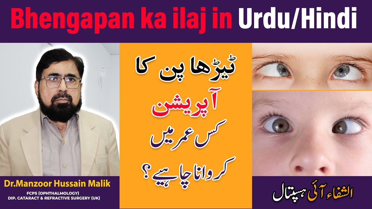 Bhengapan ka ilaj in Urdu/Hindi | Squint Eye Treatment - YouTube