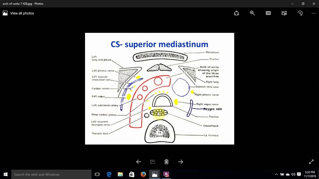 (Relations and Course of the)Arch of the aorta - YouTube