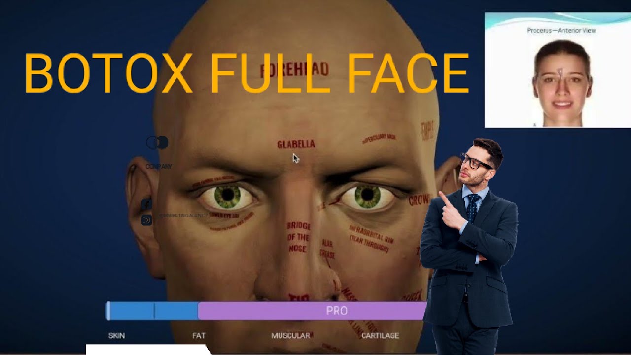 Botox Injection With Full Videos Explain Upper Face YouTube Botox Injection With Full Videos Explain Upper Face YouTube