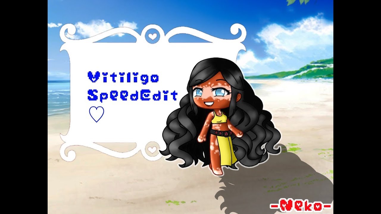 Vitiligo- SpeedEdit Gacha life- - YouTube