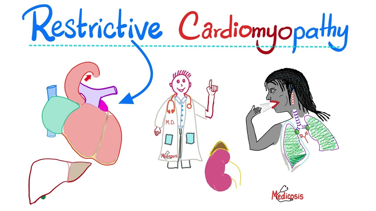 Restrictive Cardiomyopathy Pathophysiology