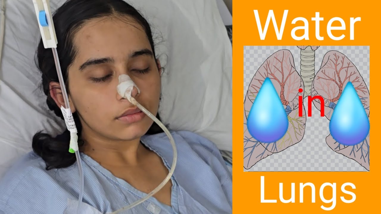 EMERGENCY! Jiya's Battle with Fluid in the Lungs - A Scary Health ...