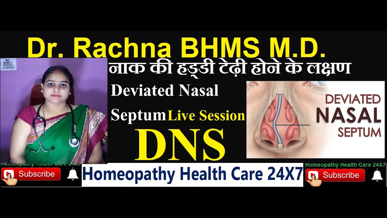 🔴Live Video-Homeopathy Treatment of Deviated Nasal Septum (DNS) Full ...
