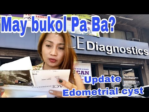 VLOG#143 BUKOL SA MATRES ( endometrial cyst) NAWAWALA BA AFTER MO ...