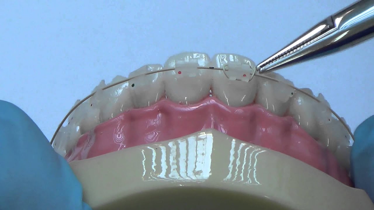 Cfast Metal Ligatures - YouTube