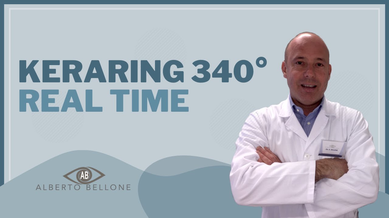 Keraring 340° REAL TIME: Implanted a ring for nipple keratoconus - YouTube