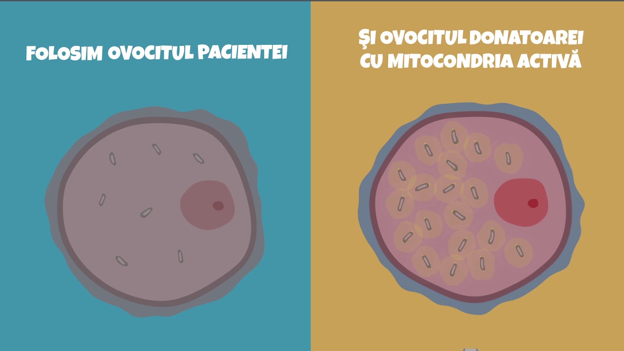 Falsitate val Deschis celula eucariota microscop ascult muzica Termic ... Falsitate val Deschis celula eucariota microscop ascult muzica Termic ...