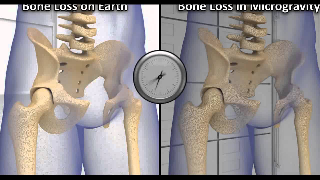 Space Bone Density Decreases in Space What to Do! Video - YouTube