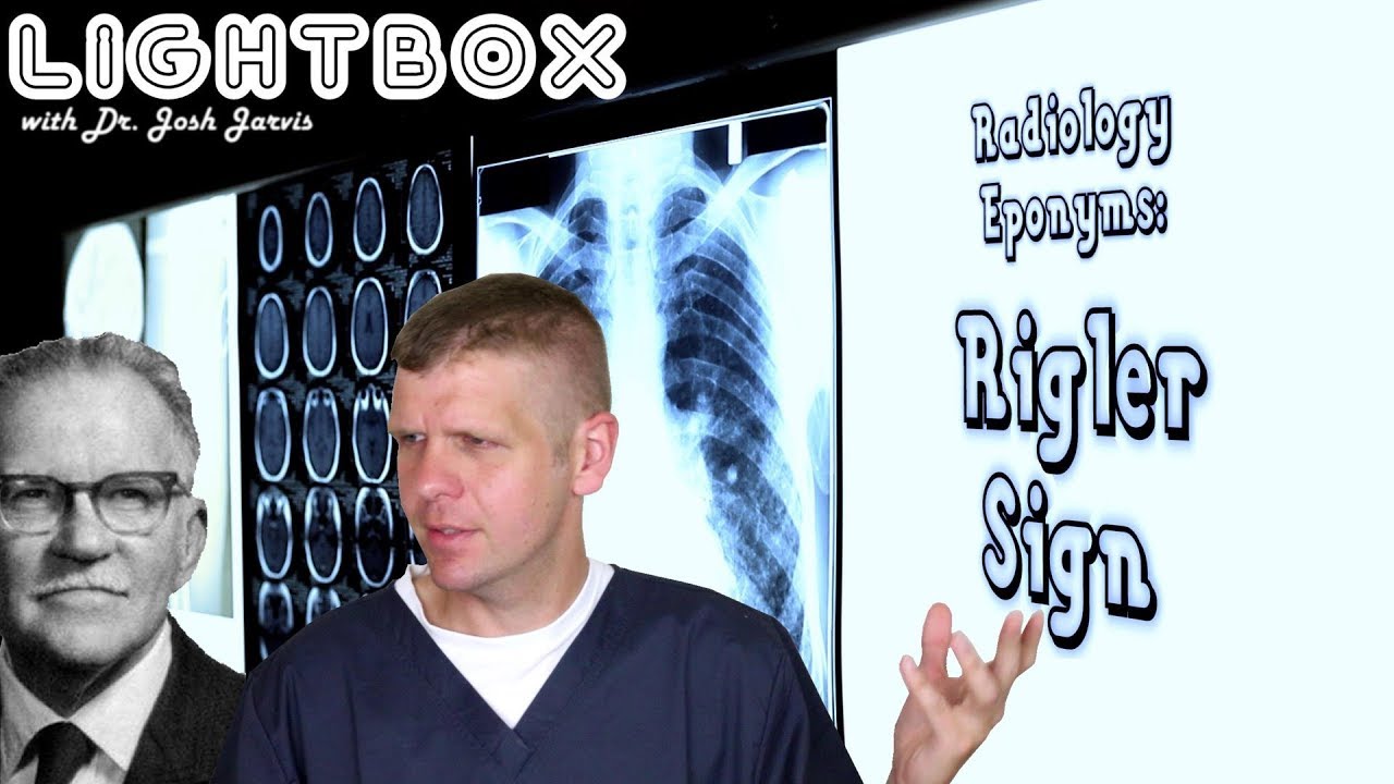 Radiology Eponyms: Rigler Sign - YouTube