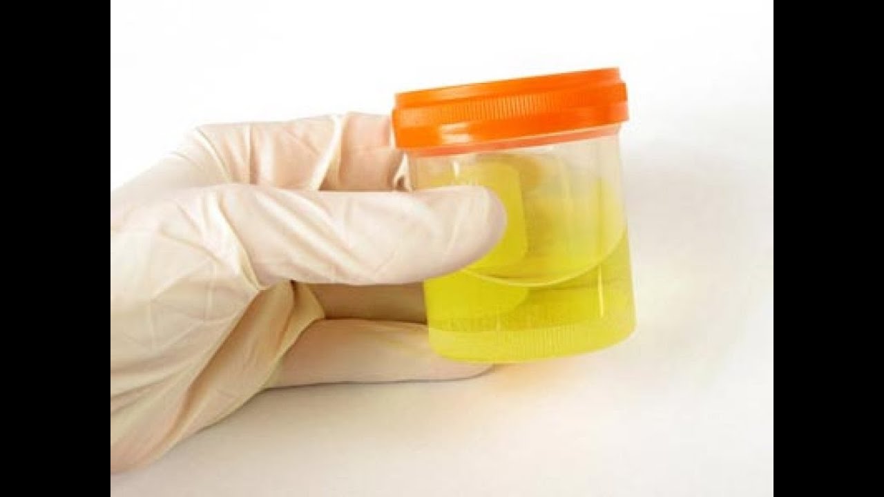 Urine Therapy Harry Matadeen & The Melon Man - YouTube