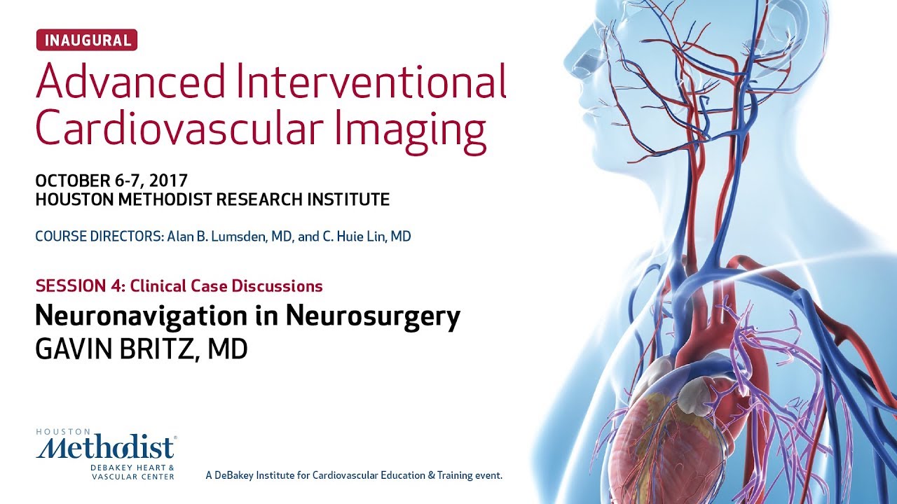 Neuronavigation in Neurosurgery (GAVIN BRITZ, MD) - YouTube