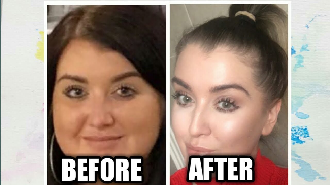 Amazing Before And After Weight Loss Pictures For Motivation It's No ...
