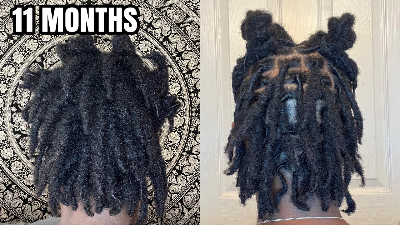 11 Month Loc Update with PICTURES | What to Expect on a Loc Journey ...
