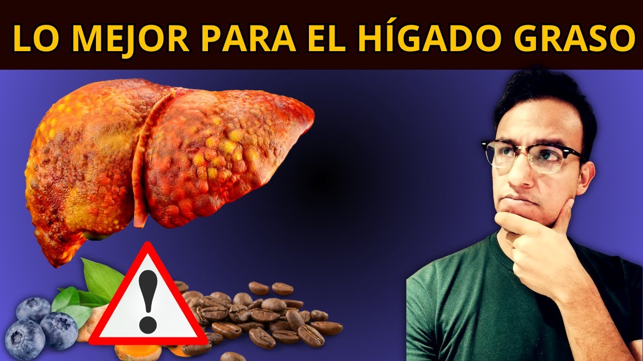 8 ALIMENTOS CRUCIALES PARA EL HÍGADO GRASO - Alimentos funcionales ...