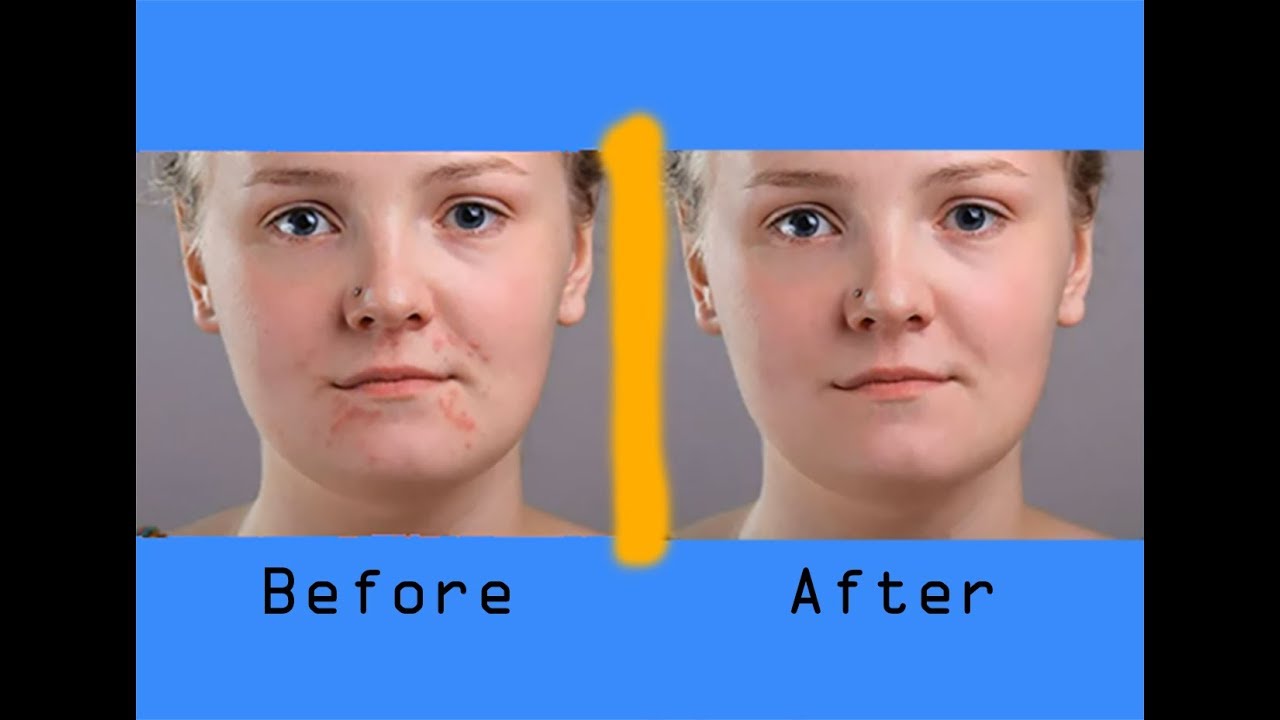 How To Make Clean Photo Face With Adobe Photoshop CC 2018 YouTube how-to-make-clean-photo-face-with-adobe-photoshop-cc-2018-youtube