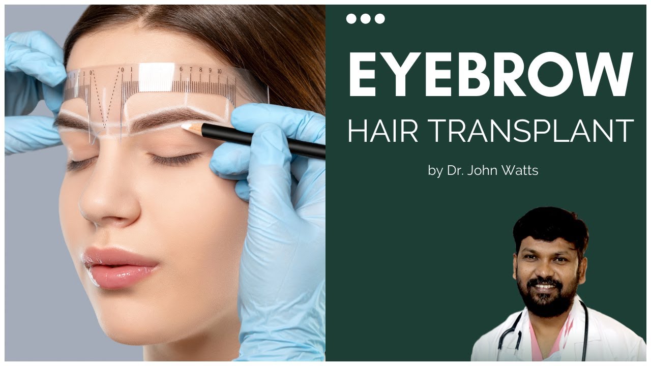 #DrJohnWatts | Can You Naturally Regrow Hair on Accidentally Burnt ...