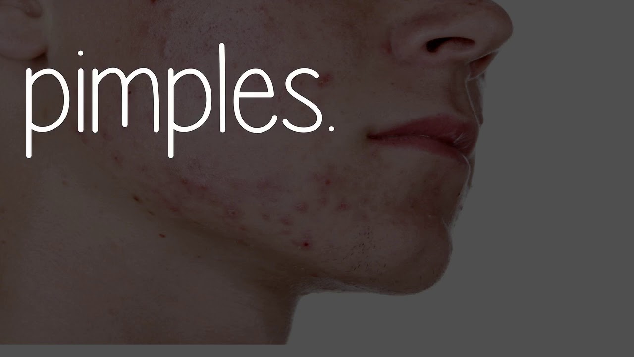 How Can I Quickly Reduce Redness And Promote Healing To Acne Scabs ...