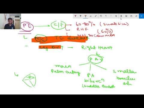 EMBOLISM-TYPES, MECHANISM, PATHOLOGY - YouTube