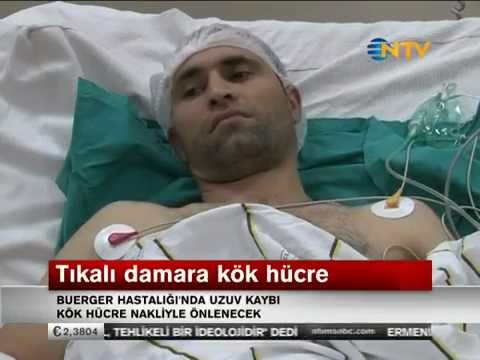 SİGARA İÇENLERİN SONU BUDUR