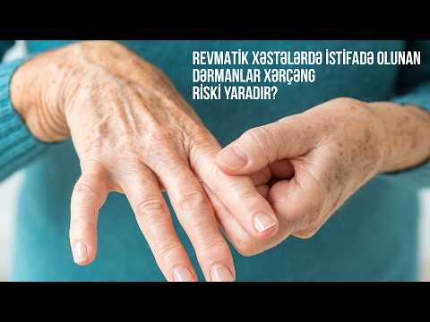 Revmatik xəstələrdə istifadə olunan dərmanlar xərçəng riski yaradır?