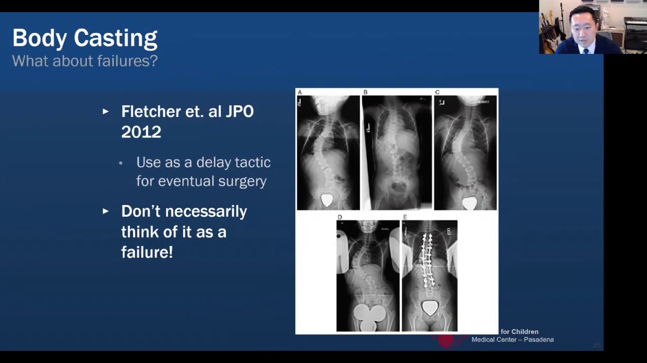 Pediatric Spinal Deformities