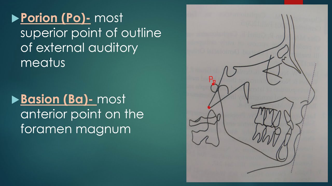 CEPHALOMETRIC LANDMARKS - YouTube