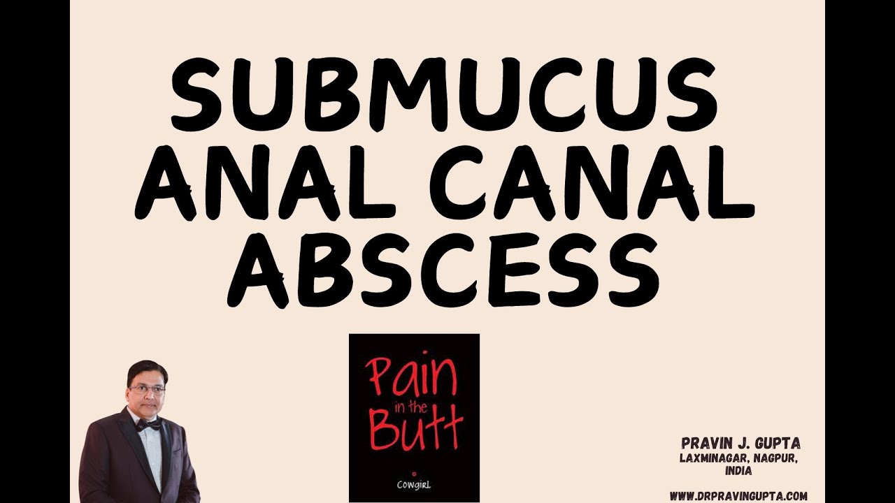 ANAL CANAL ABSCESS SURGERY - YouTube