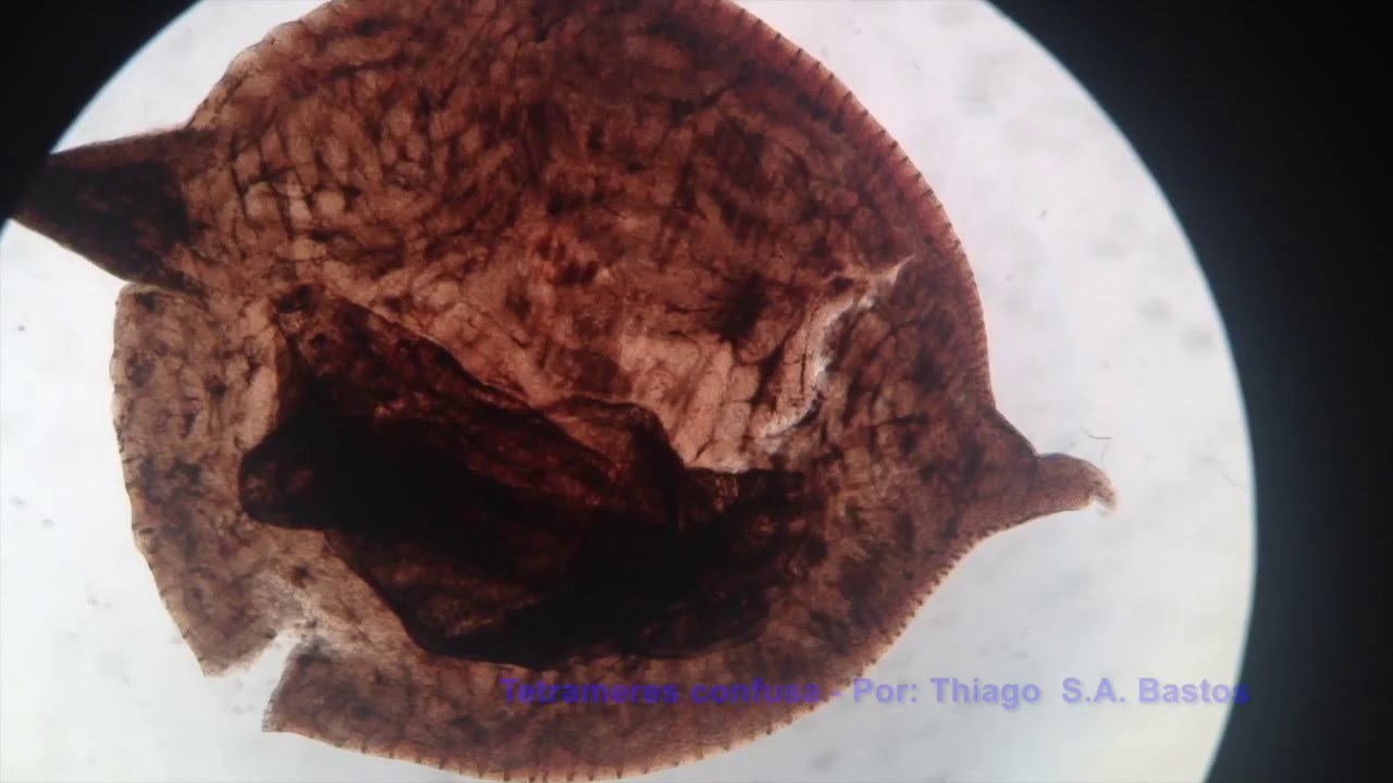 Tetrameres confusa ♀ - YouTube