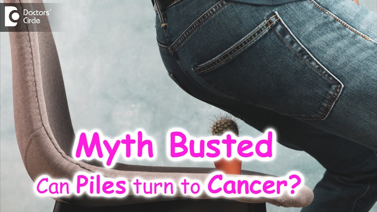 Can piles turn to cancer? Myths & Facts | Talk by Proctologist- Dr ...