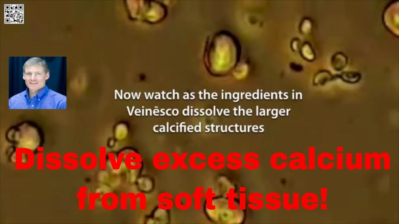 NanoBacTx: Rid excess calcium from tissues incl. arteries, kidneys ...