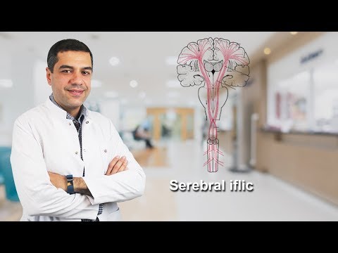 Dr. Kamran Salayev  Ixtisas: Uşaq nevroloqu  Mövzu: Serebral iflic